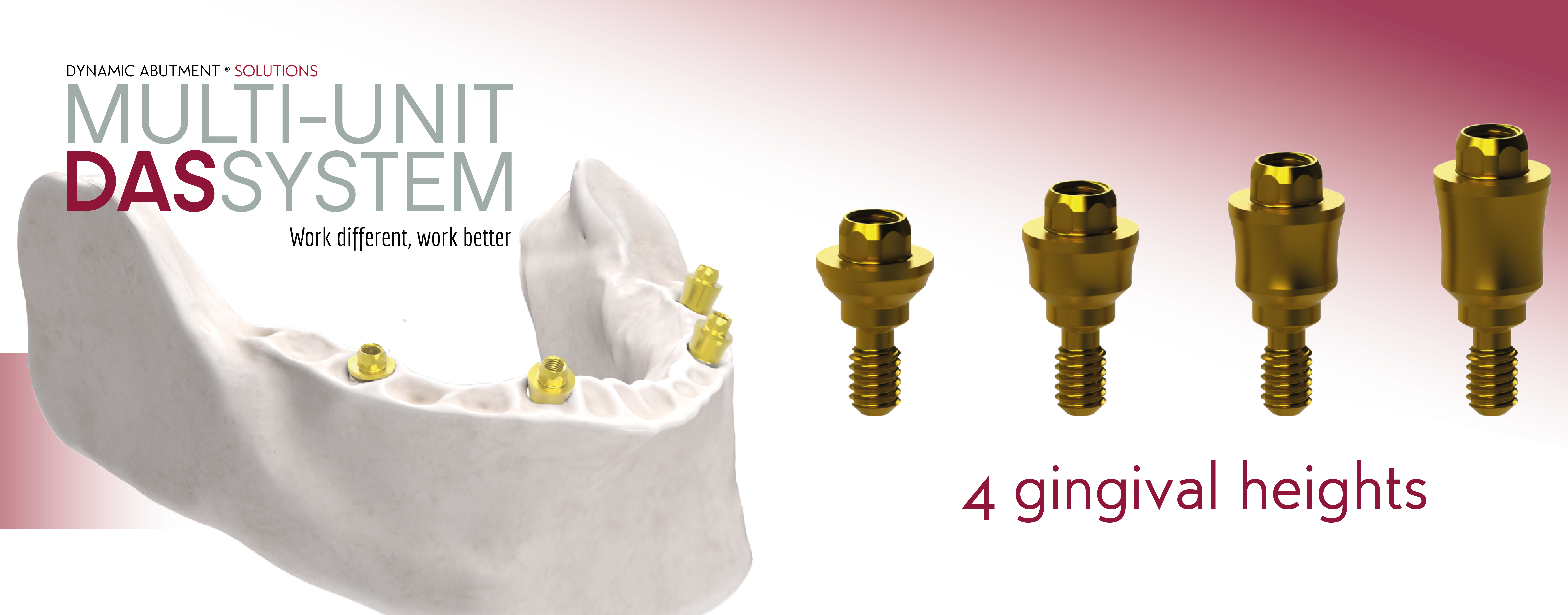Dynamic Abutment Solutions