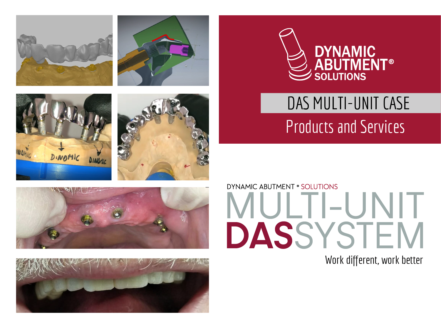Dynamic Abutment Solutions