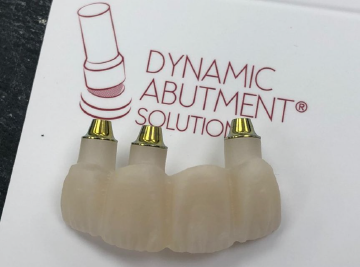 Dynamic Abutment Solutions